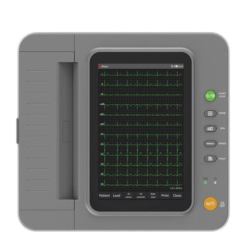 CONTEC E12 Digital Touch 12 channel ECG Machine ECG Electrocardiograph – GulfMoon Healthcare